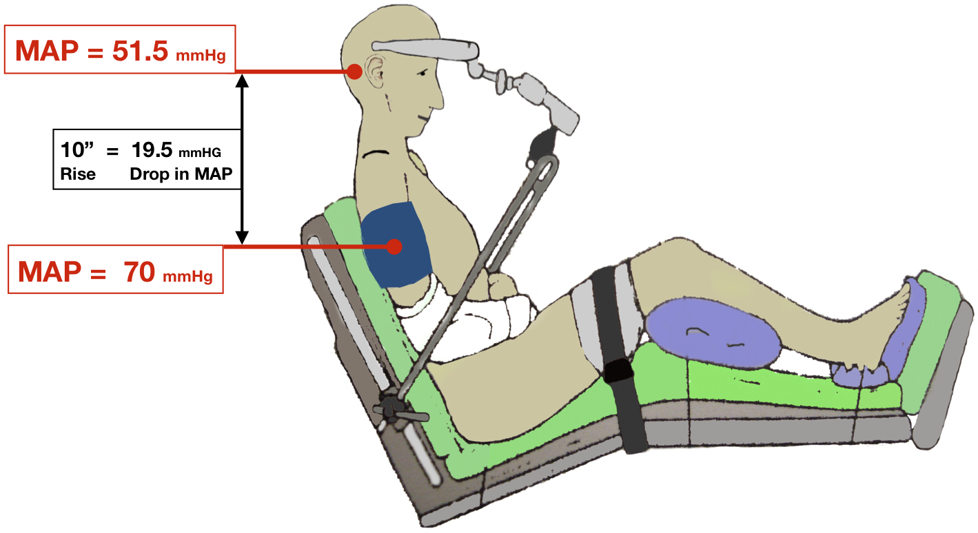 Brain Injury or Paralysis From Seated Surgeries | Clore Law | Clore Law ...